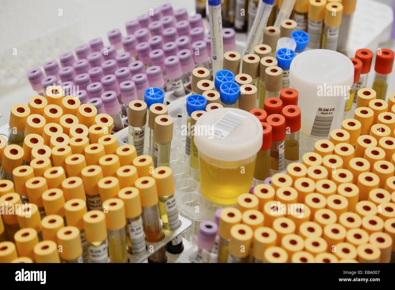 Hemogram hi-res stock photography and images - Alamy