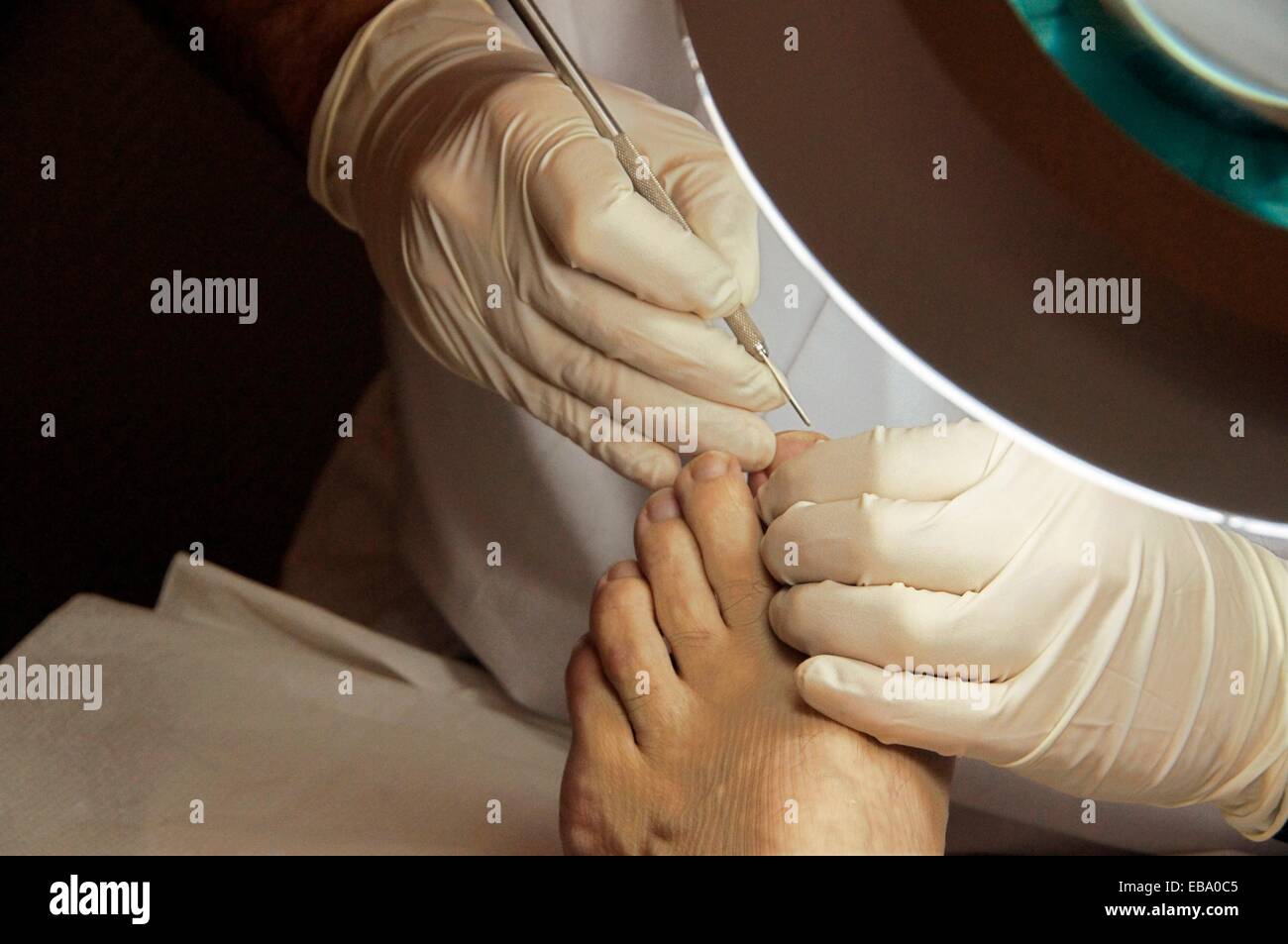 Podologist hi-res stock photography and images - Alamy