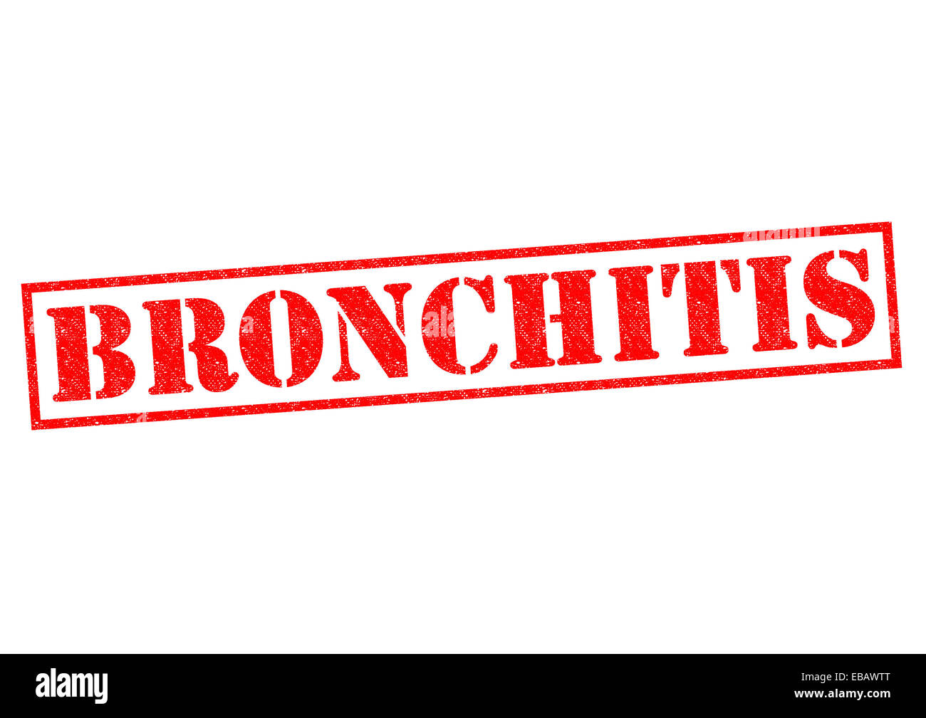 Acute bronchitis hi-res stock photography and images - Alamy