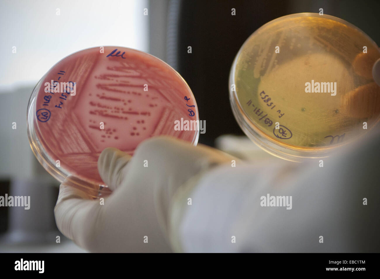 E coli hi-res stock photography and images - Alamy