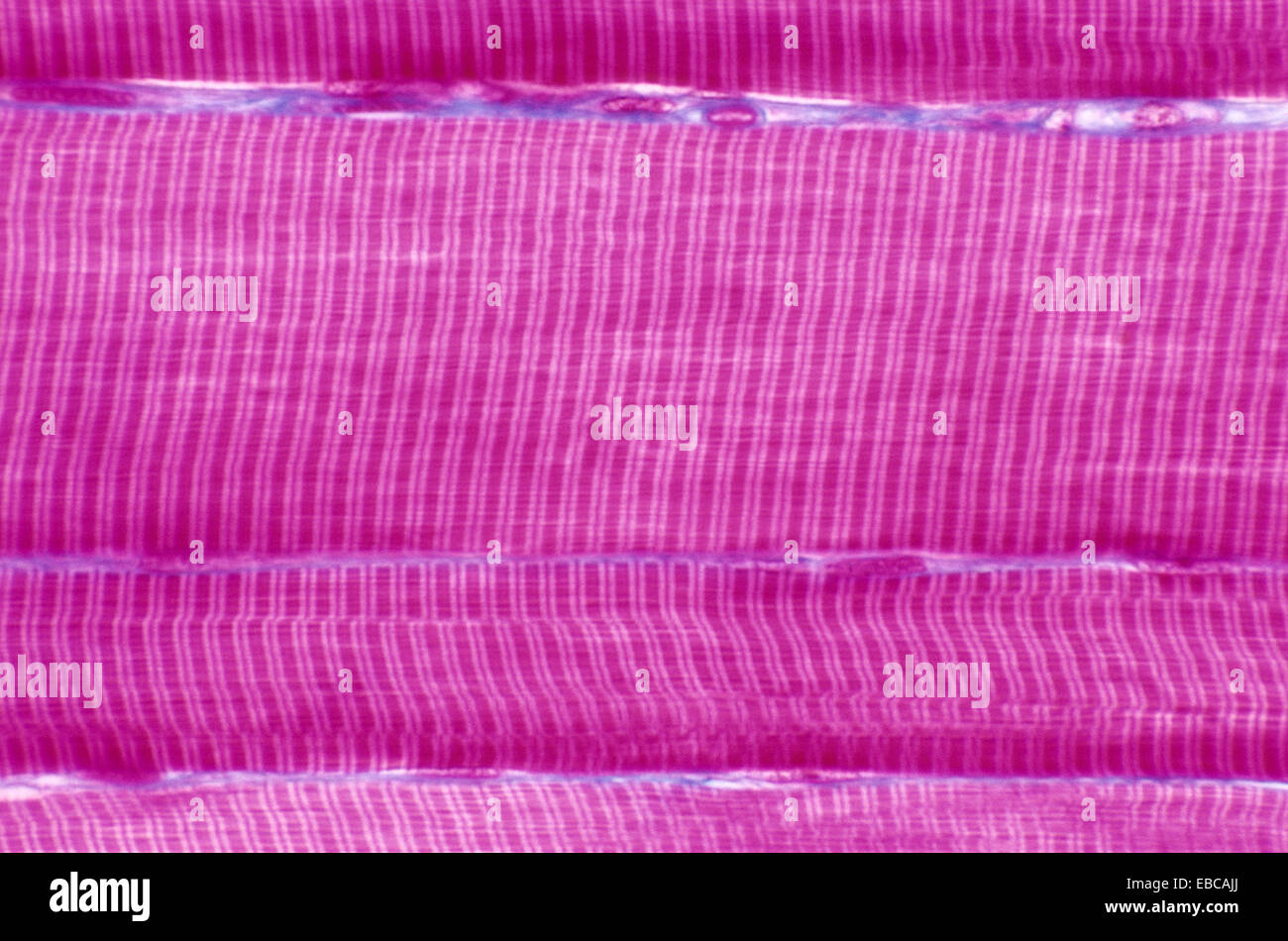 Striated Muscle Skeletal High Resolution Stock Photography and Images - Alamy