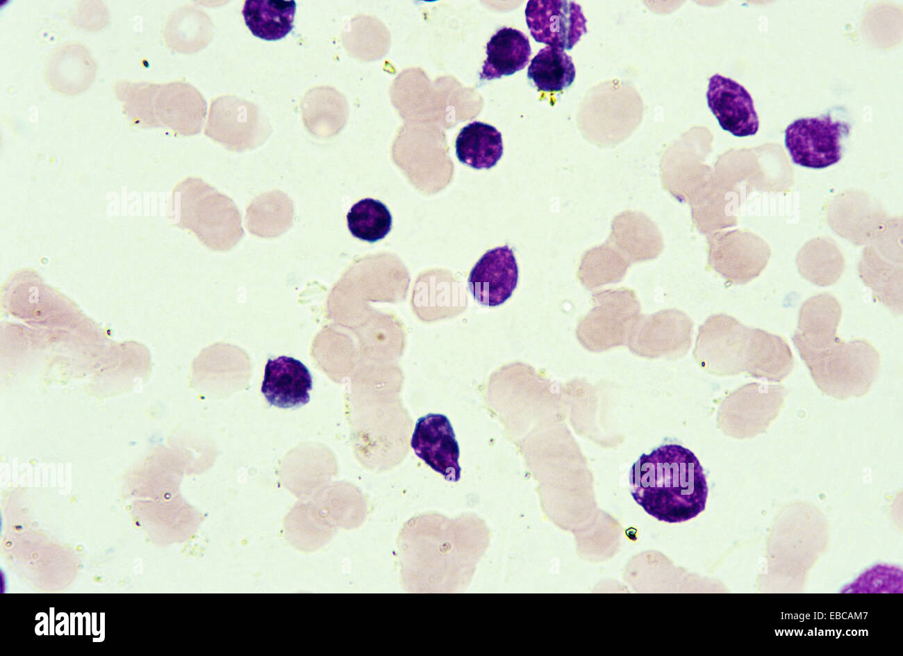 Platelets Microscope High Resolution Stock Photography and Images - Alamy