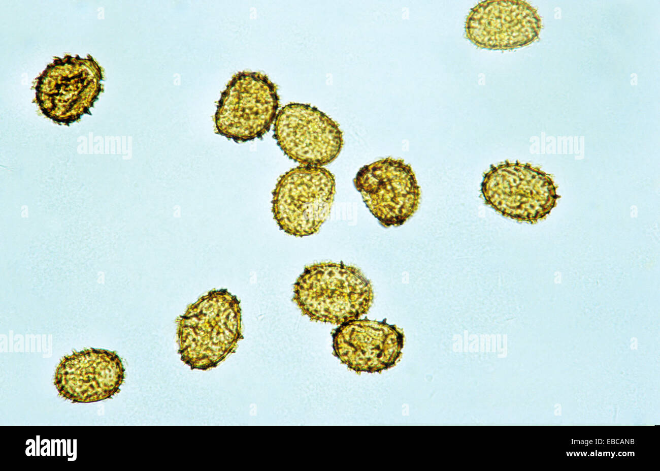 Fern Spores Microscope