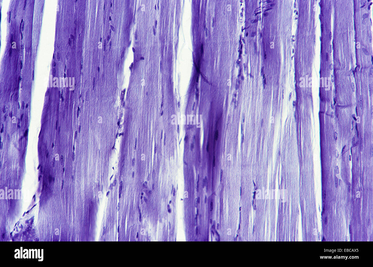 Striated Muscle High Resolution Stock Photography and Images - Alamy