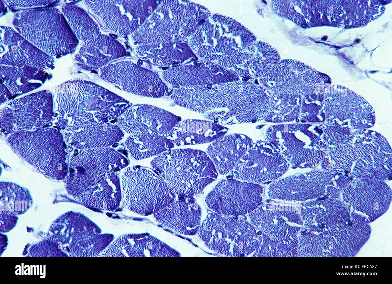 Skeletal Muscle Cross Section