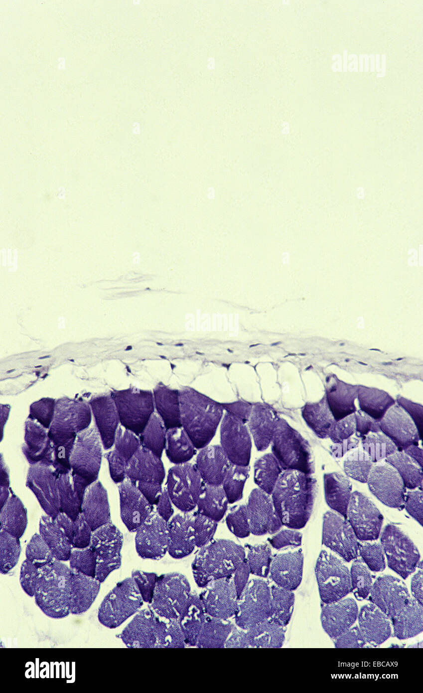 Striated Muscle Skeletal High Resolution Stock Photography and Images ...