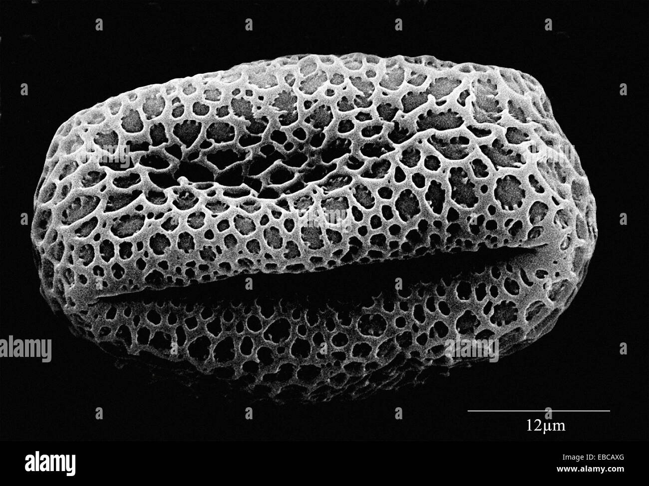 Electron Microscope Pollen High Resolution Stock Photography and Images ...