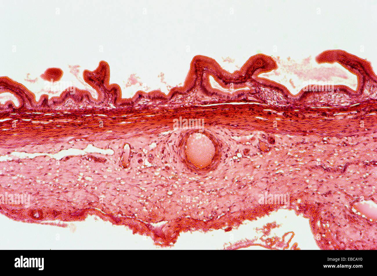 Cross Section Of The Gallbladder High Resolution Stock Photography and ...