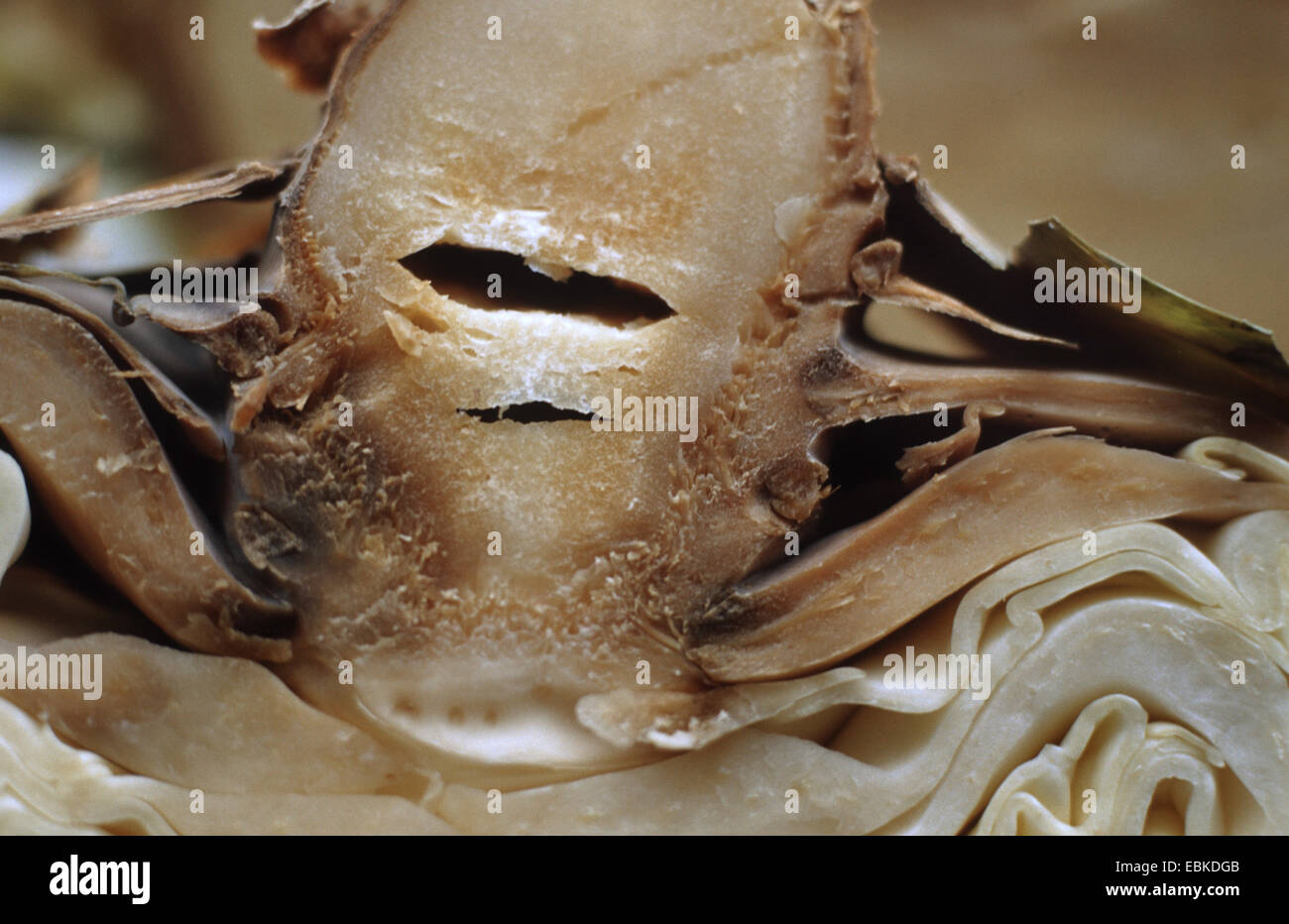 Cabbage disease hi-res stock photography and images - Alamy