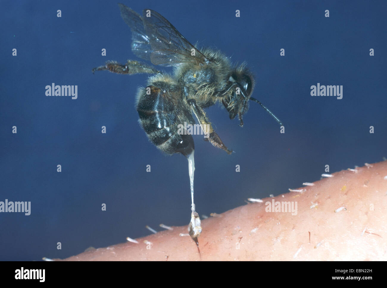Bee sting skin hi-res stock photography and images - Alamy