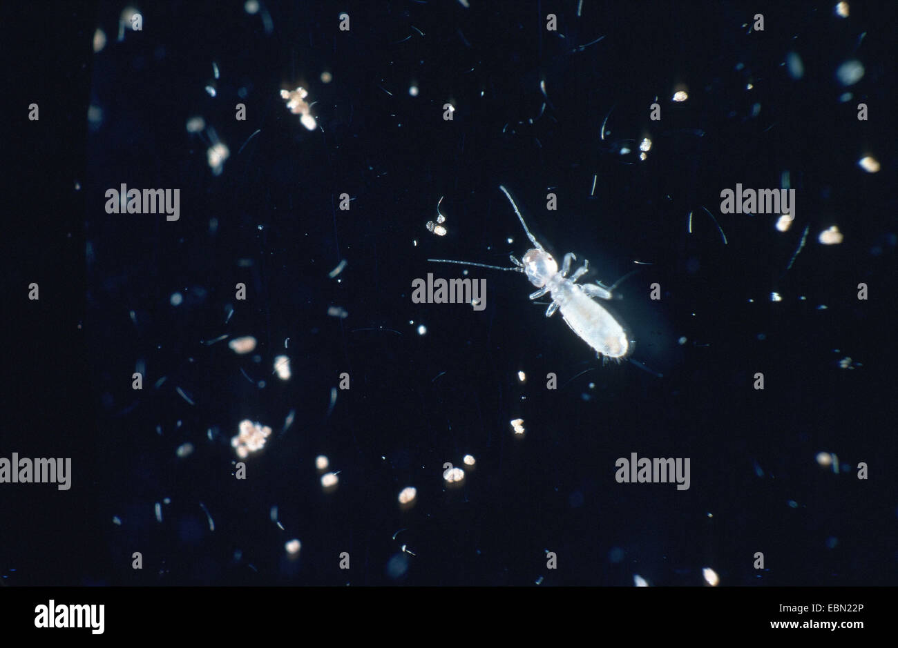 booklouse (Liposcelis divinatorius), microscopic image Stock Photo - Alamy