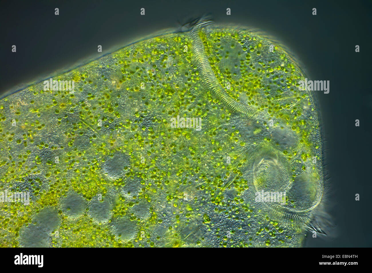 green trumpet animalcule (Stentor polymorphus), differential ...