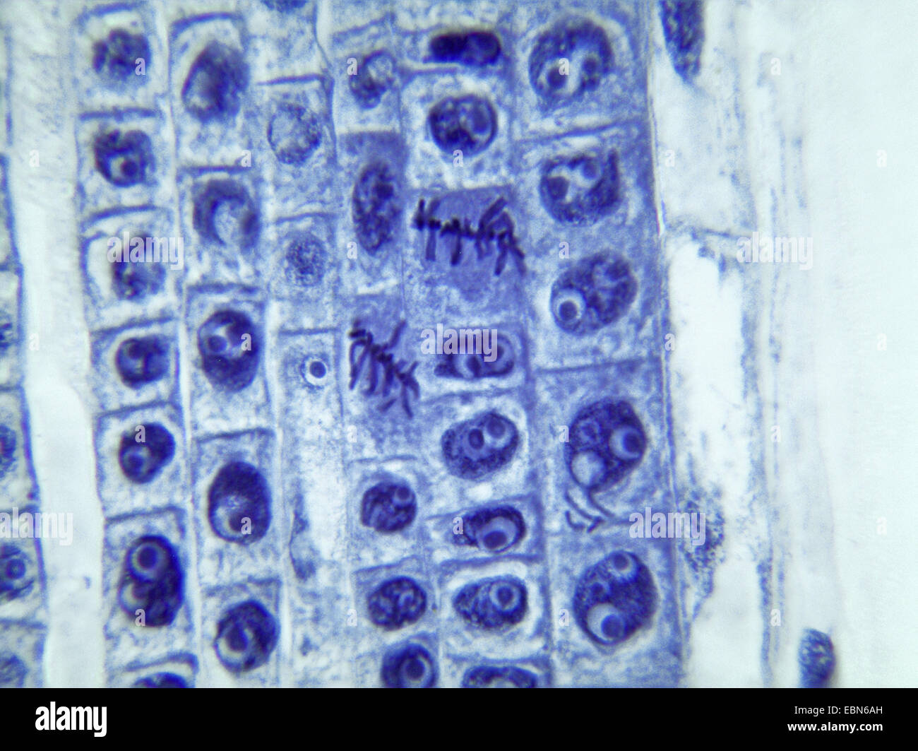 Metaphase Of Mitosis