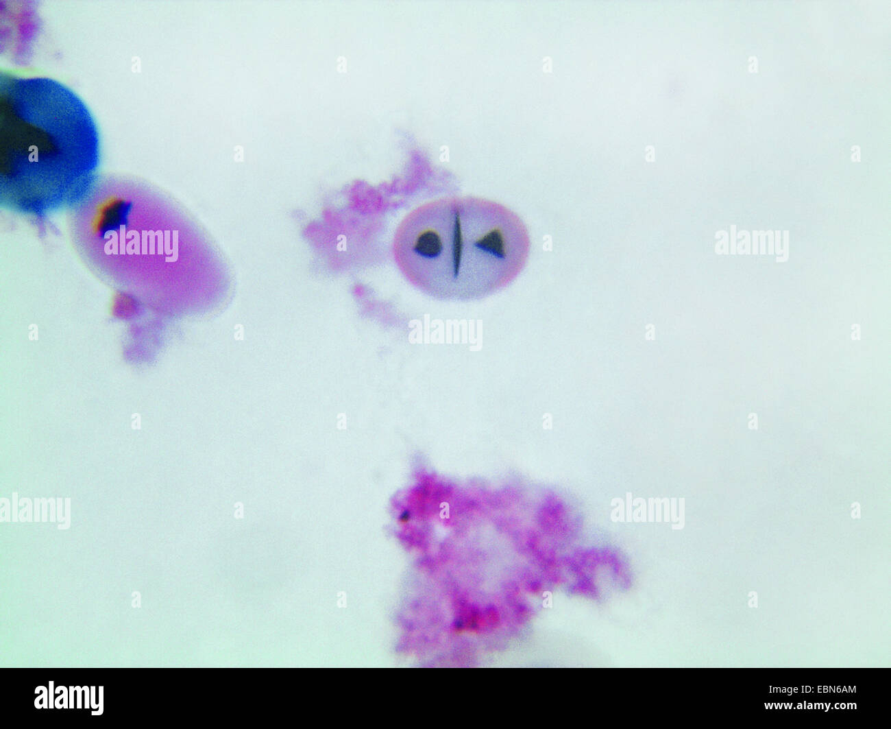 Stained Potato Under Microscope