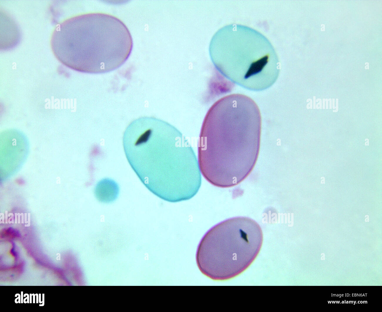 potato (Solanum tuberosum), microscopic picture of potato starch grains ...