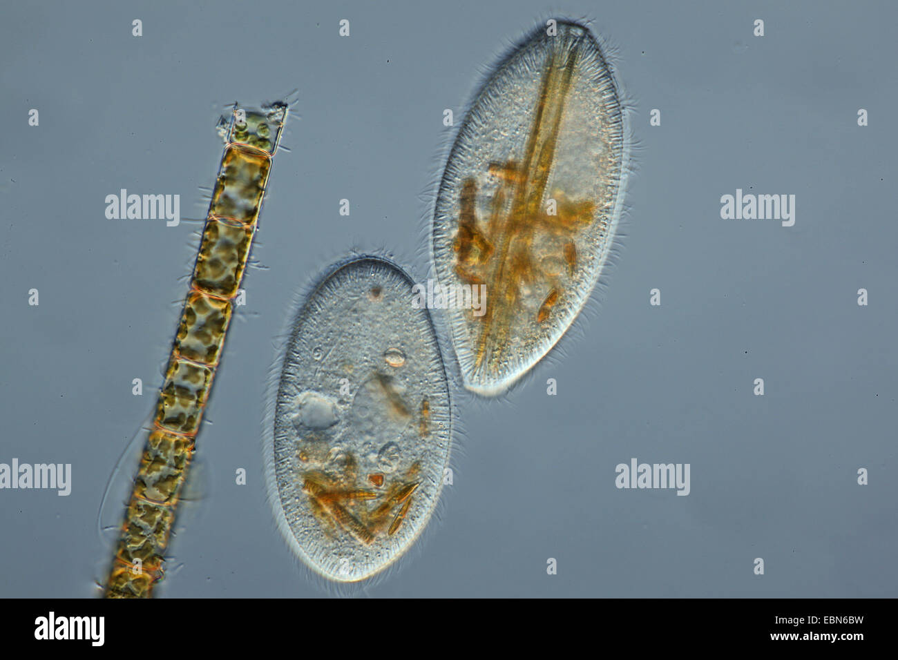Frontonia (Frontonia), in differential interference contrast Stock ...