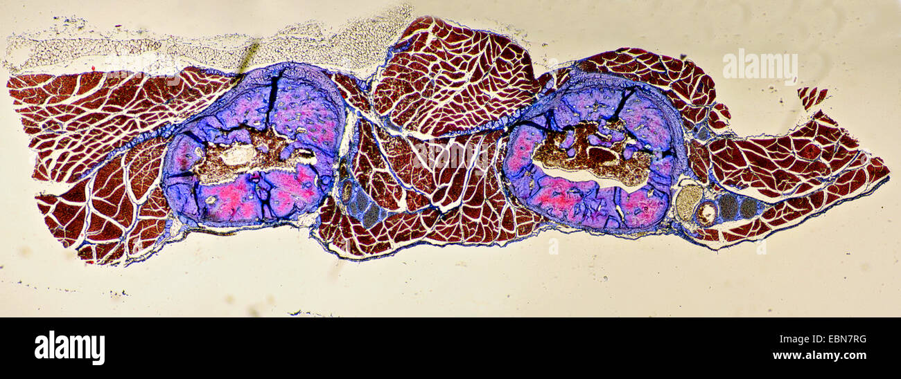 Human bone marrow hi-res stock photography and images - Alamy
