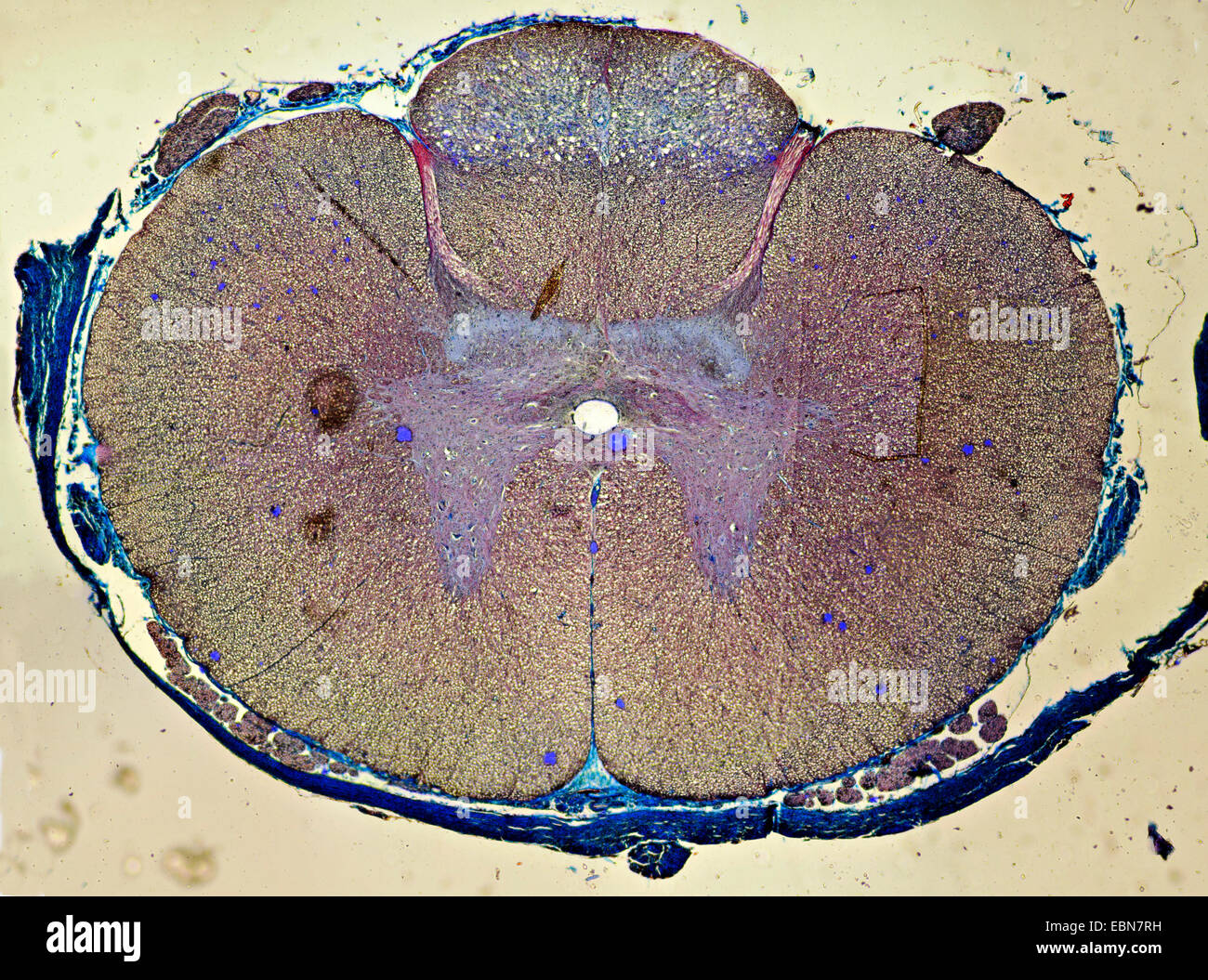 Spinal Cord Cross Section Anatomy