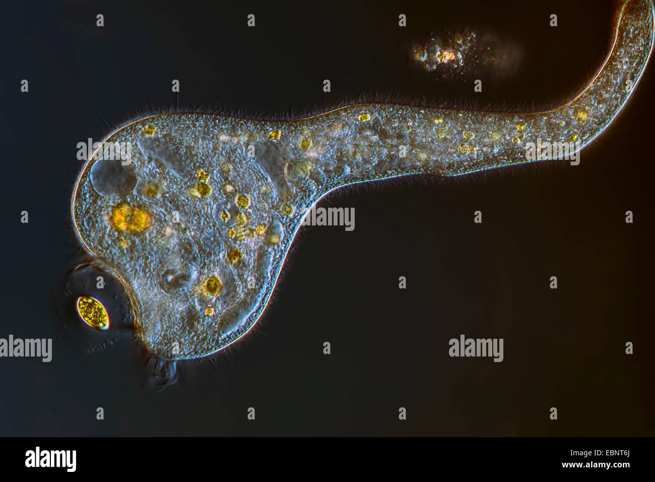Stentor Under Microscope 400x