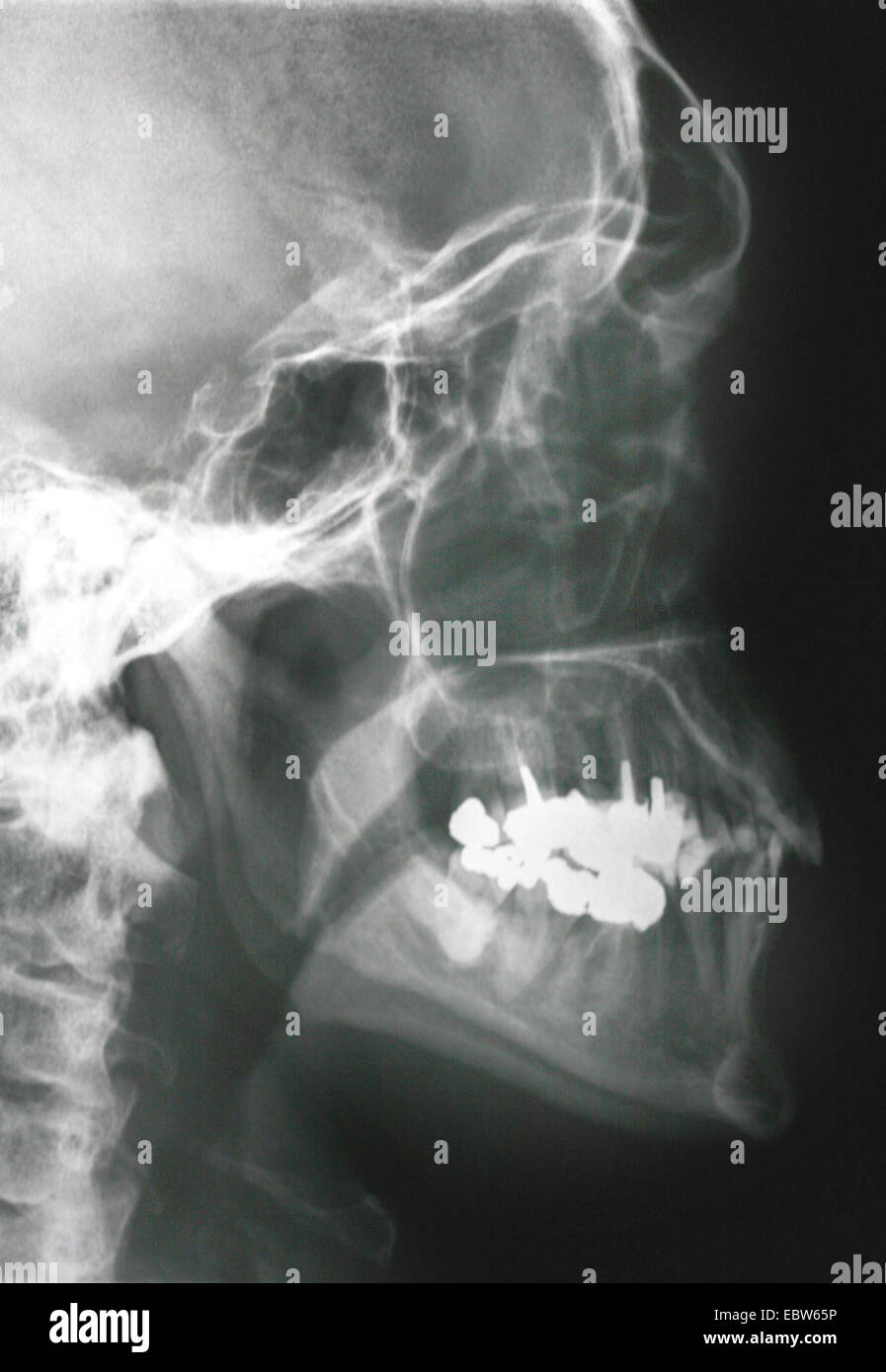 people, human beings, humans (Homo sapiens sapiens), X-ray of the human ...