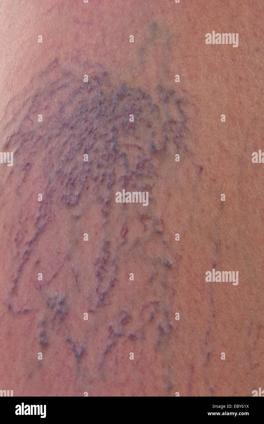 Close up veins blood hi-res stock photography and images - Alamy