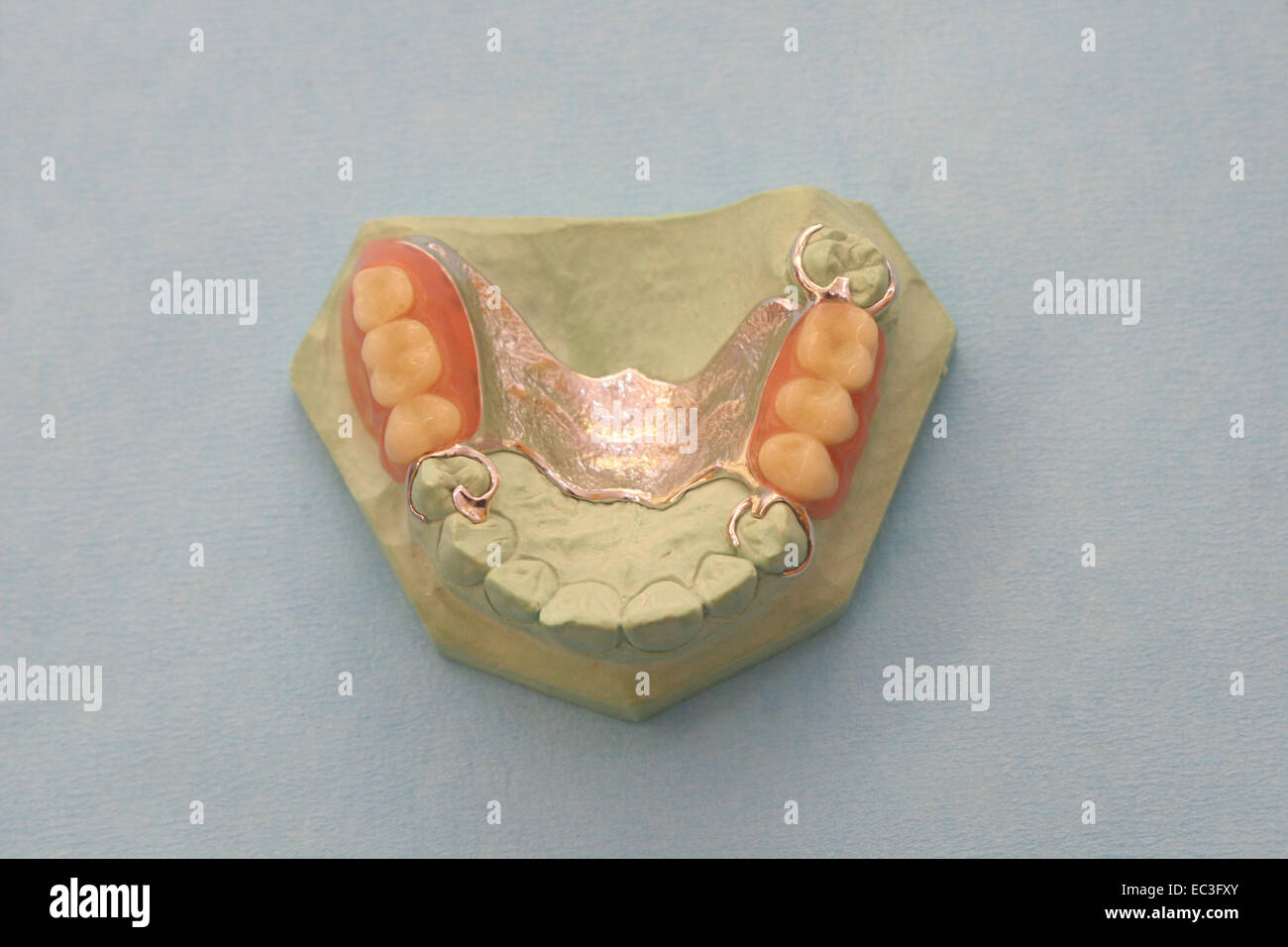 Paradentitis hi-res stock photography and images - Alamy