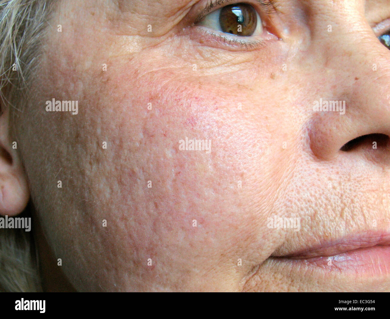 Skin Study of an elderly Woman Stock Photo - Alamy