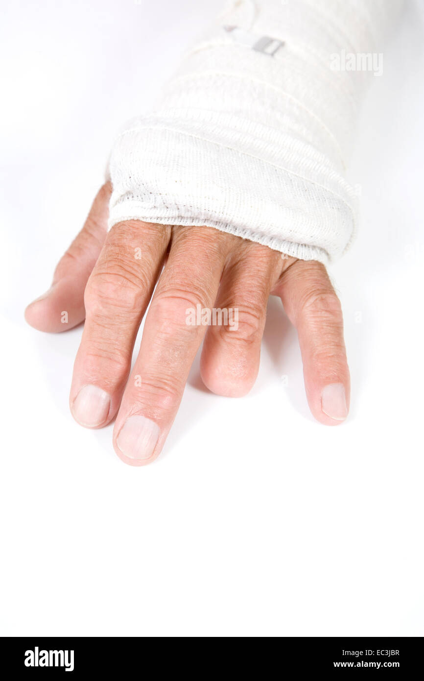 Arm cast hi-res stock photography and images - Alamy