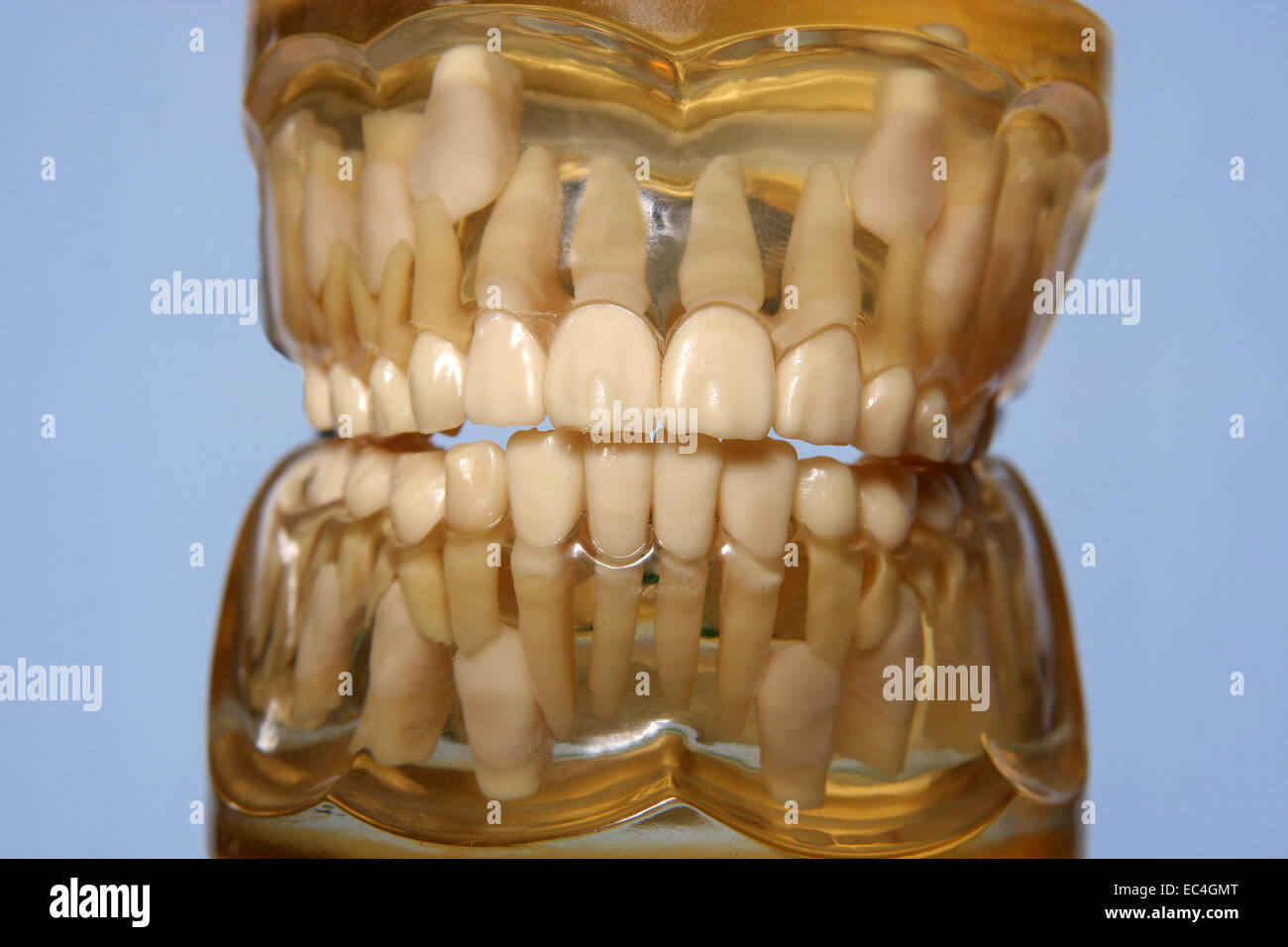 Gold teeth denture hi-res stock photography and images - Alamy