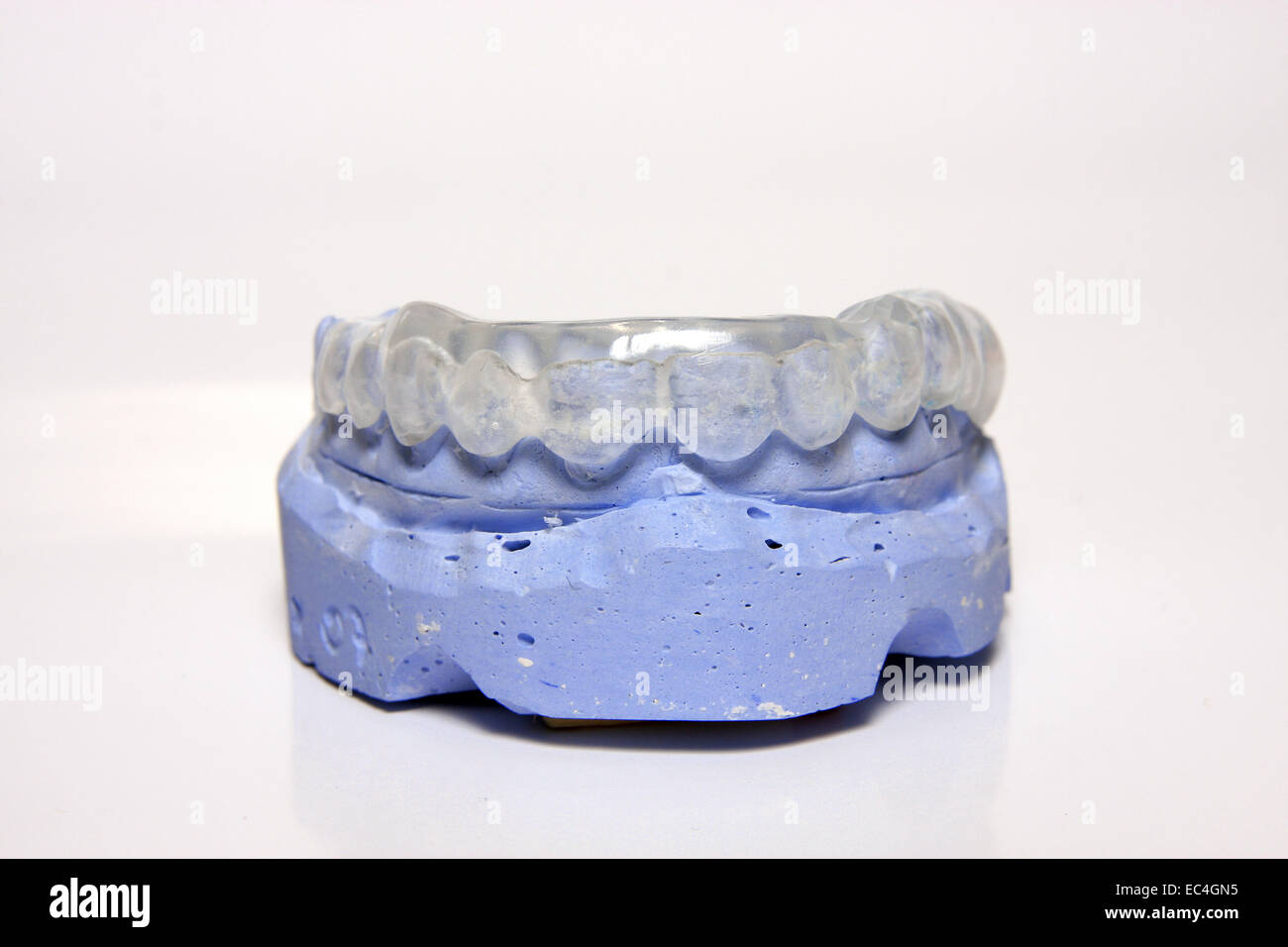 Paradentitis hi-res stock photography and images - Alamy
