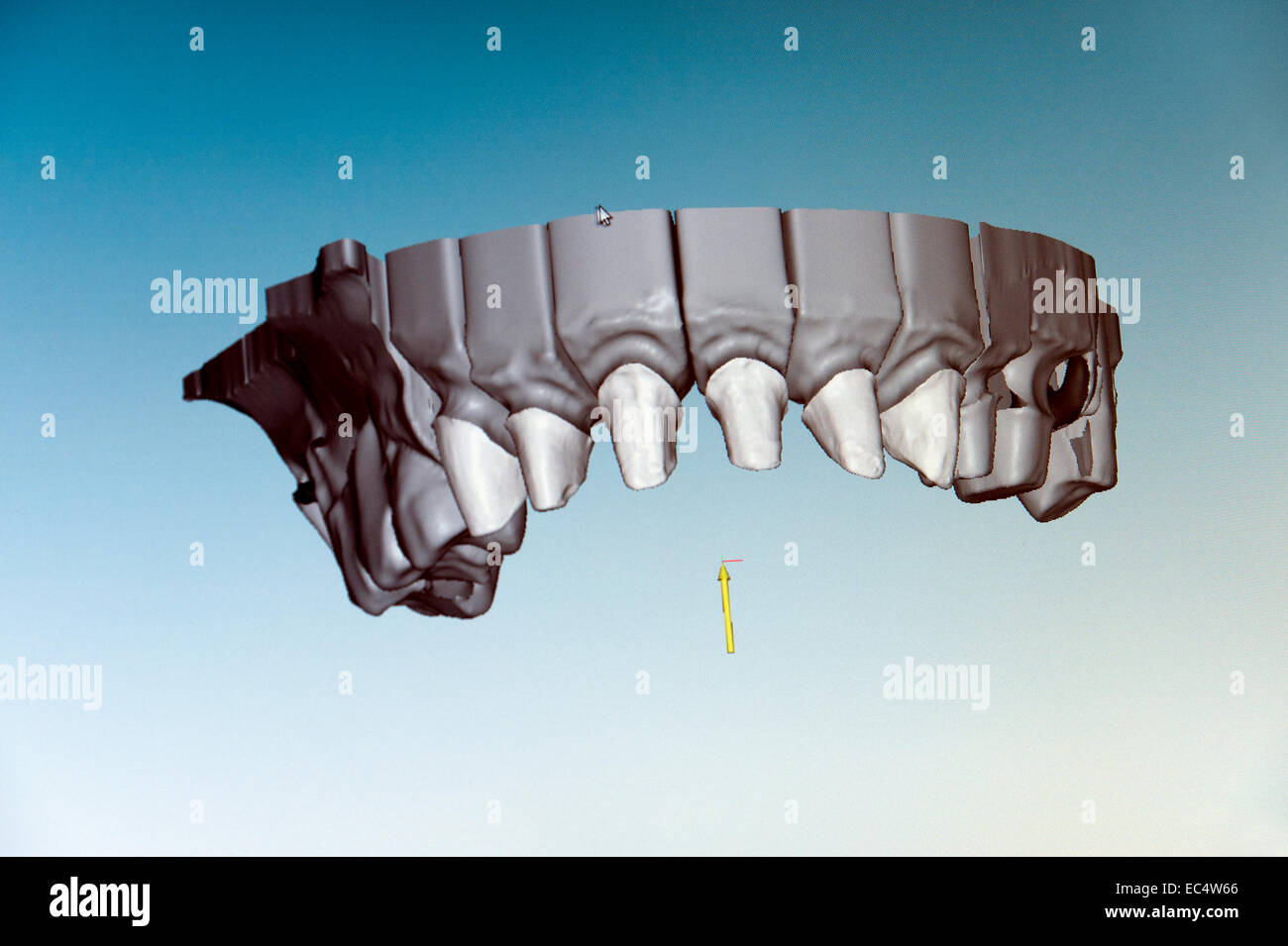 Representation of the upper jaw model on the screen Stock Photo - Alamy