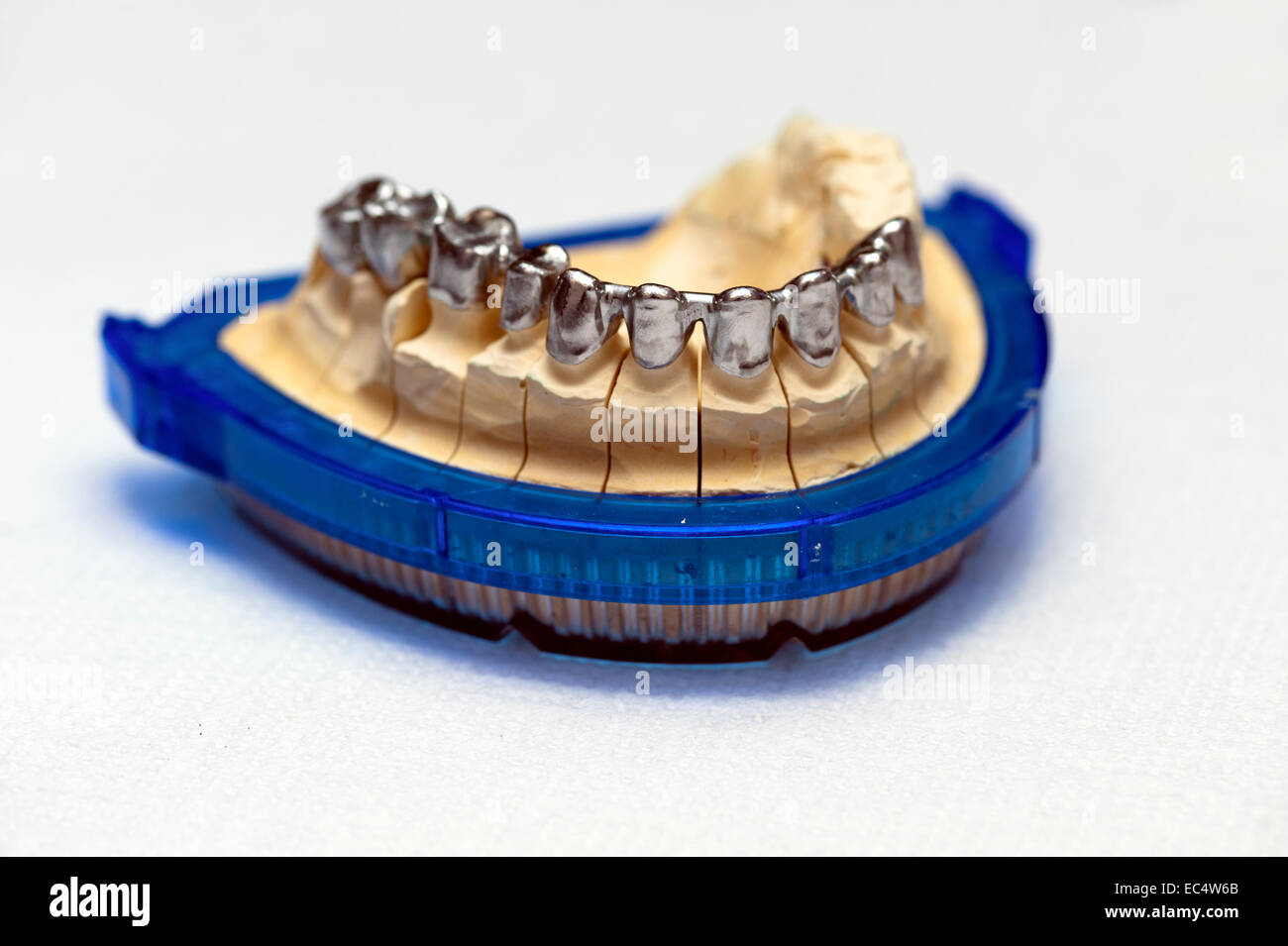 finished metal frame for ceramic crowns Stock Photo - Alamy