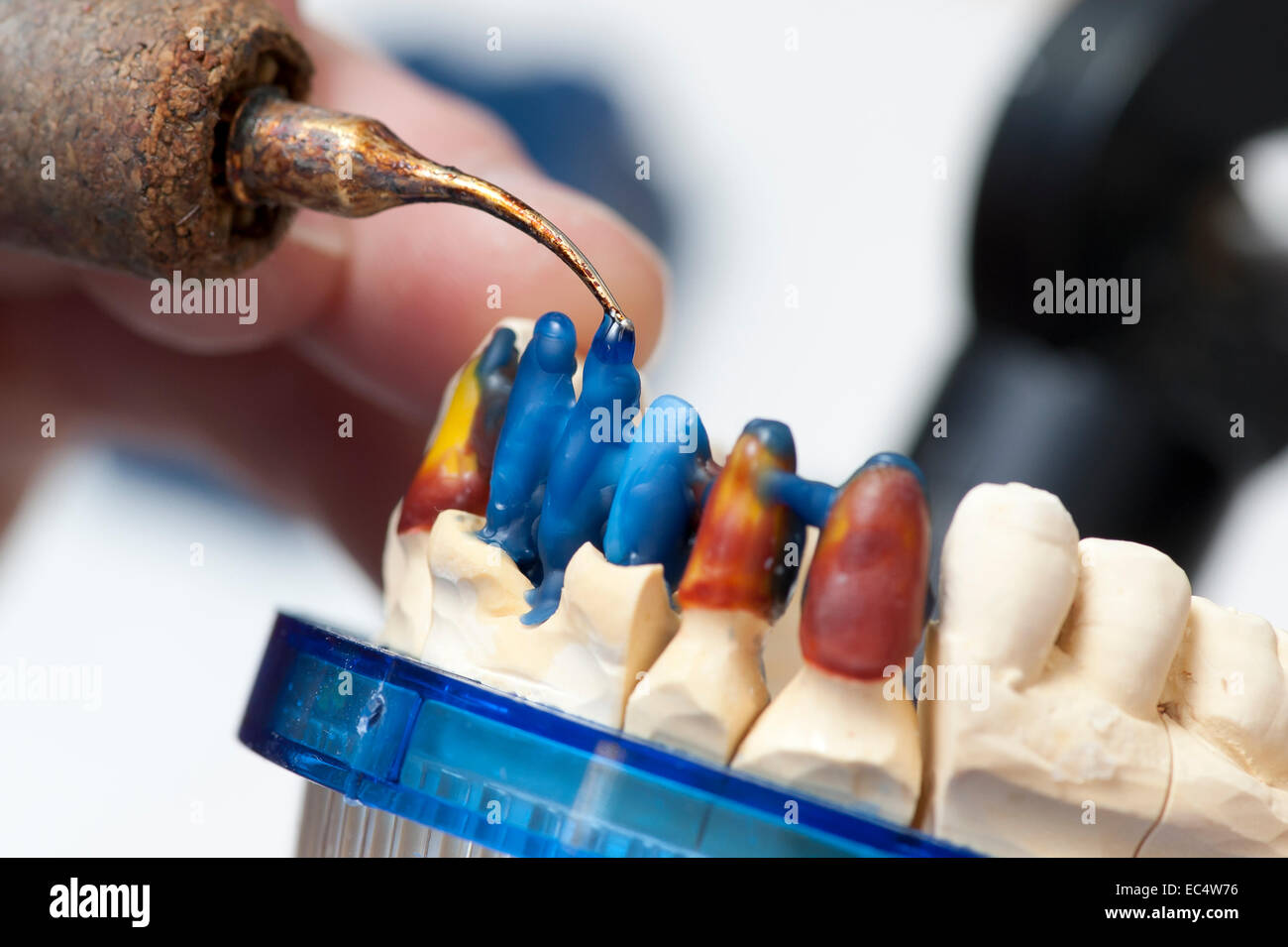 Model for dental crowns is set up with hot wax Stock Photo - Alamy