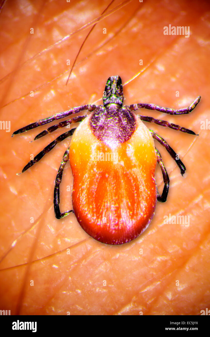 Tick insect anatomy hi-res stock photography and images - Alamy