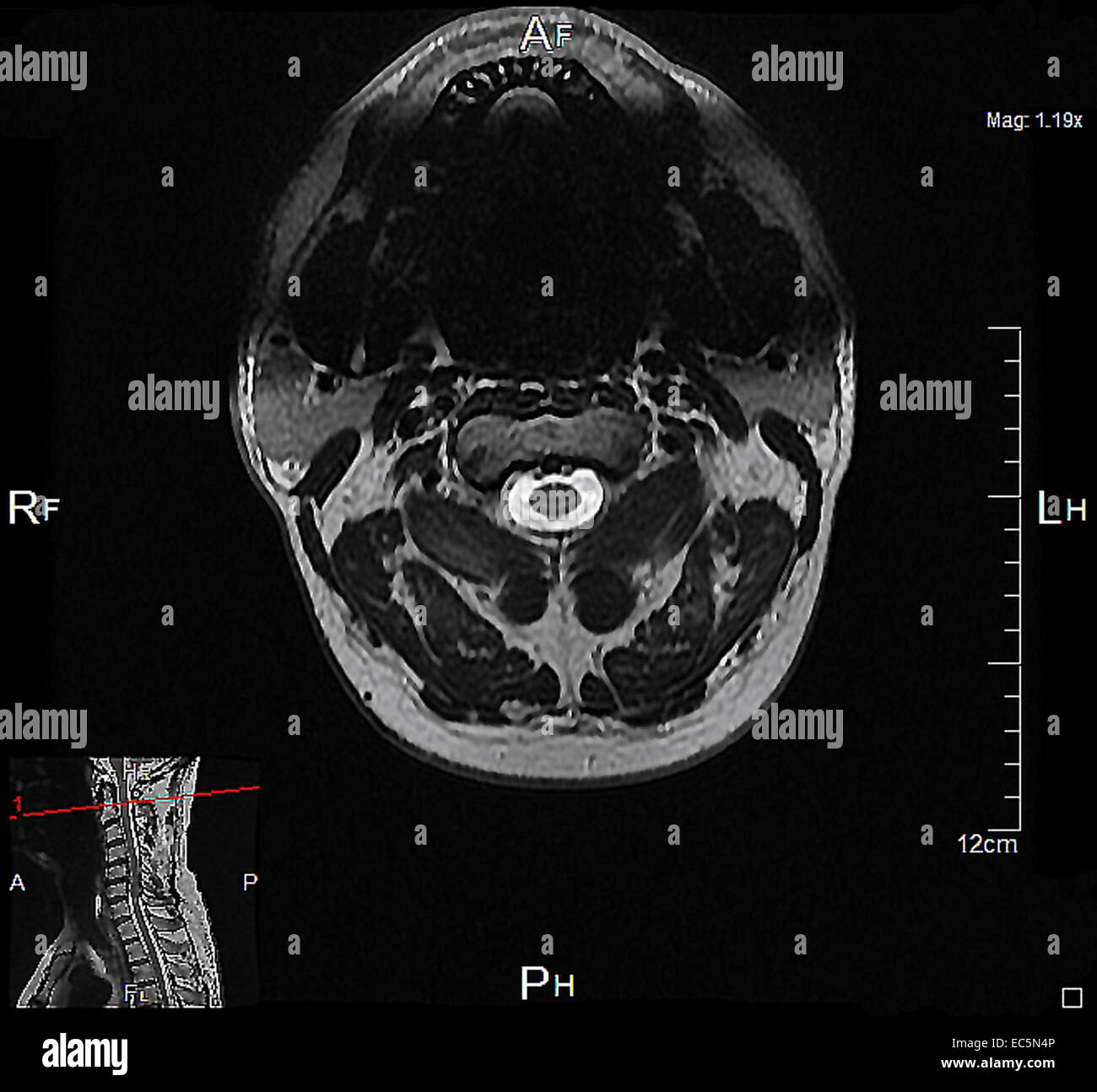 Bone imaging hi-res stock photography and images - Alamy