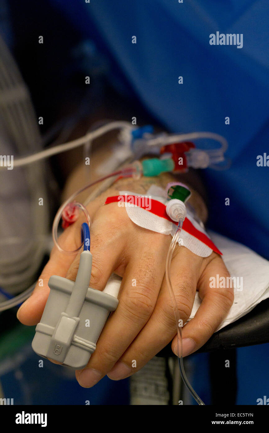 Hand of a patient in operation theatre with i.v. lines and monitoring ...