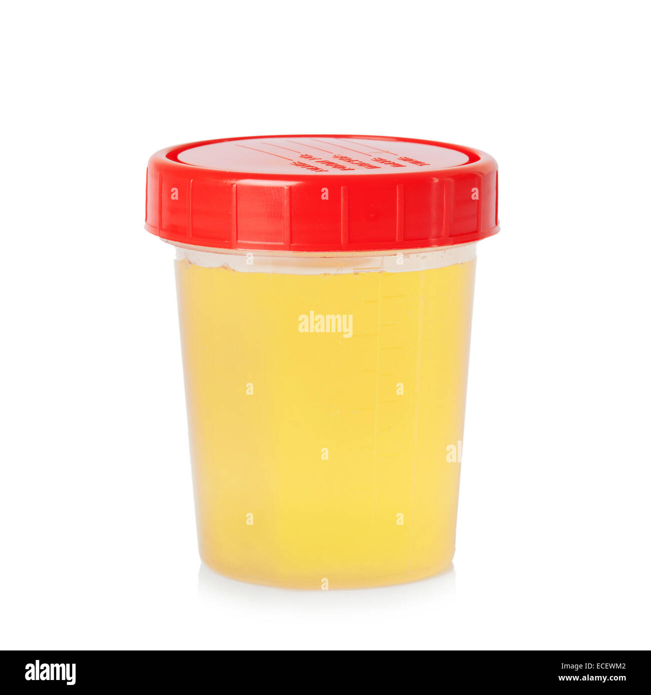 Urine sample in container isolated on white background Stock Photo - Alamy