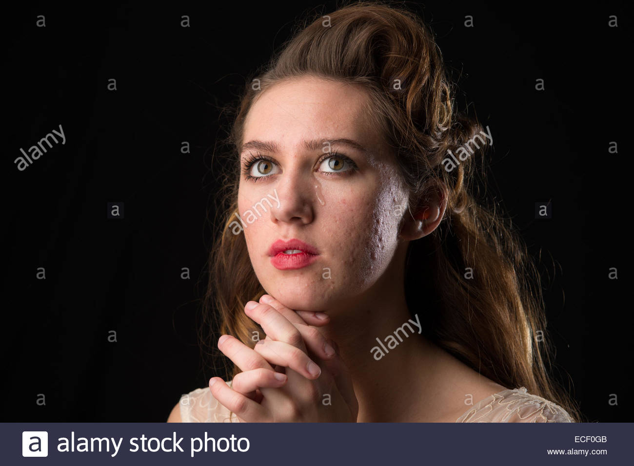 Acne Woman Face High Resolution Stock Photography and Images - Alamy