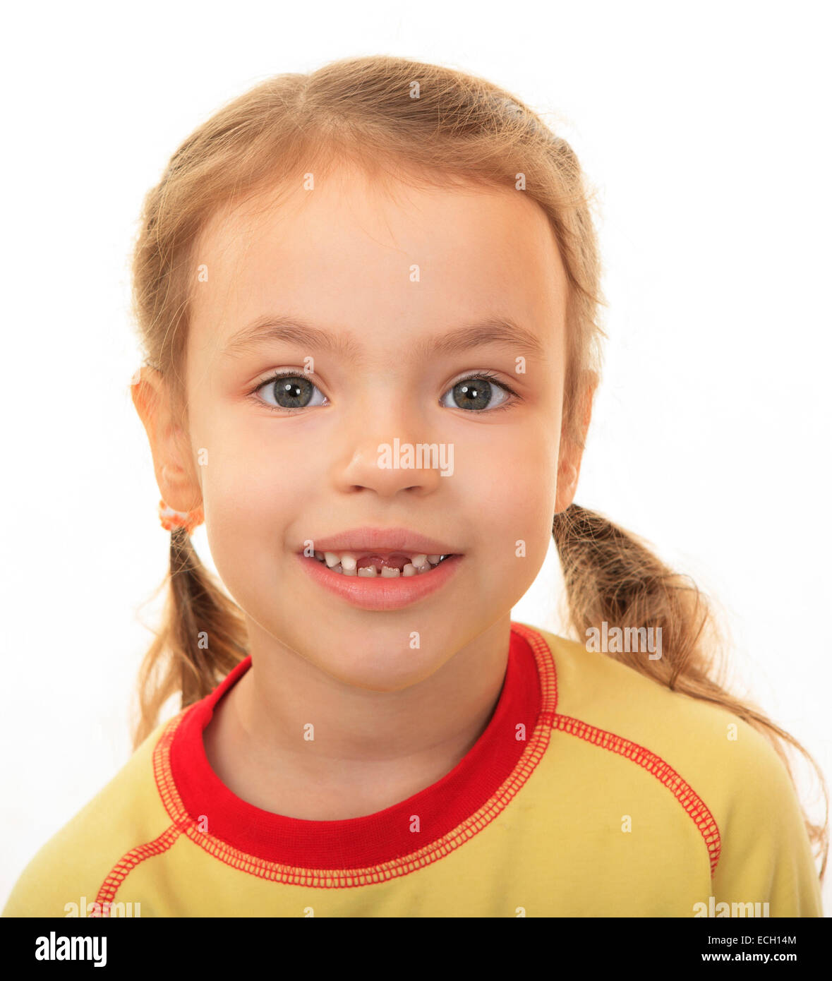 Little girl with no upper teeth Stock Photo - Alamy