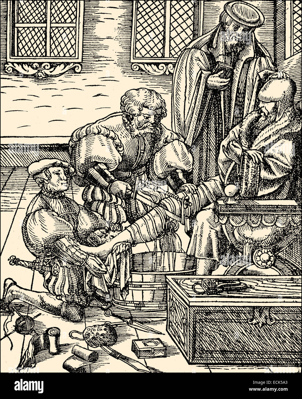 Amputation of a leg, 16th century, Amputation eines Beines im 16 ...