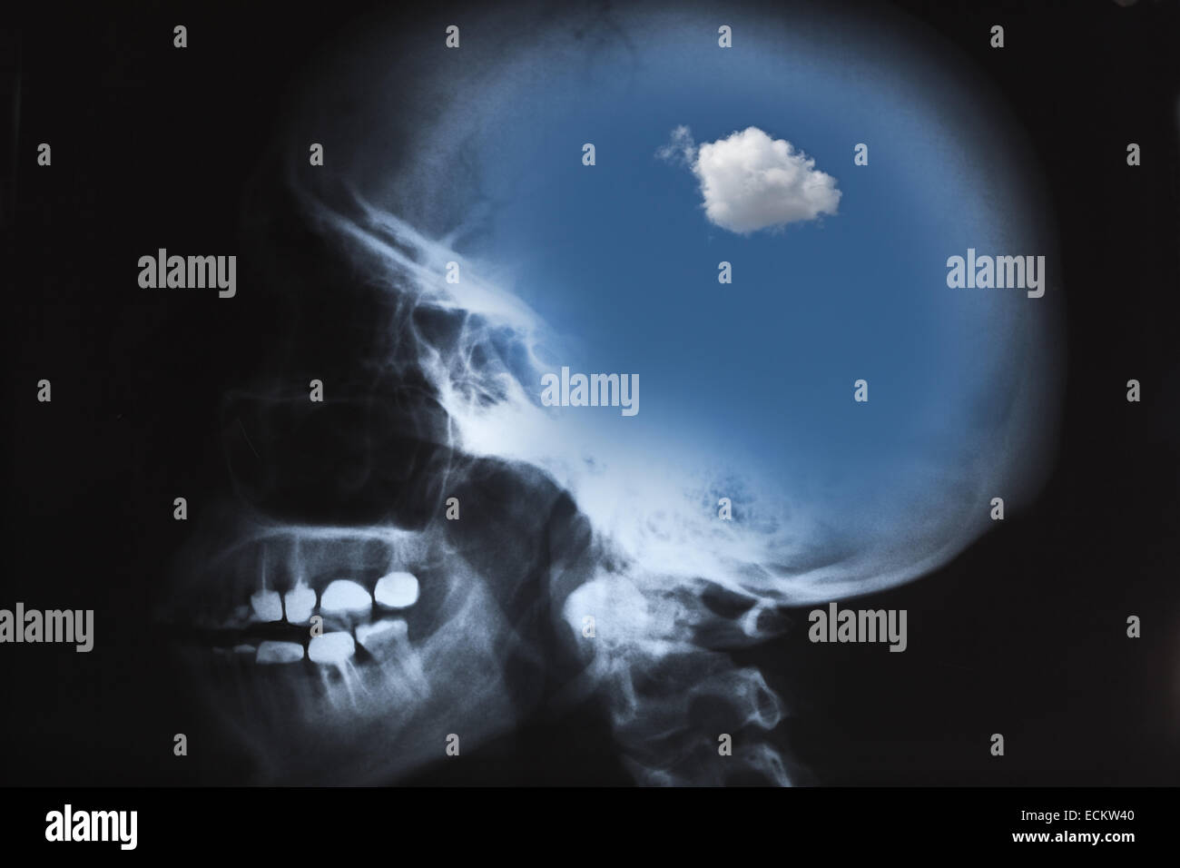 X-Ray of human skull with blue sky and cloud Stock Photo - Alamy