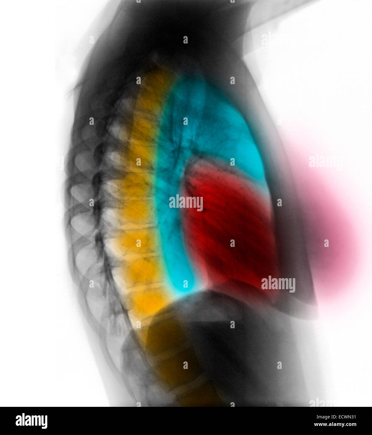 Normal chest x ray year old hi-res stock photography and images - Alamy
