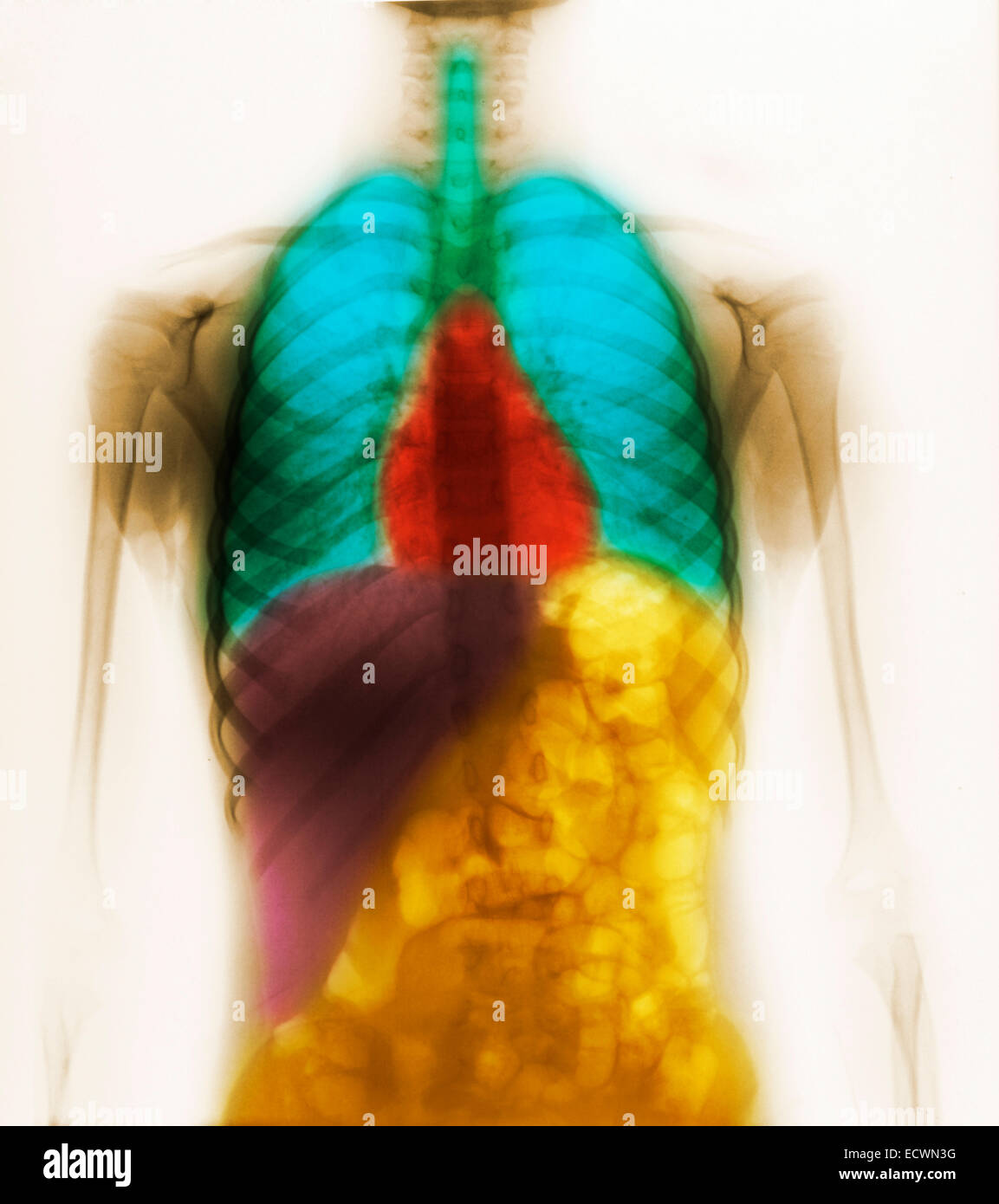 Normal chest x-ray of a 7 year 10 month old female Stock Photo - Alamy