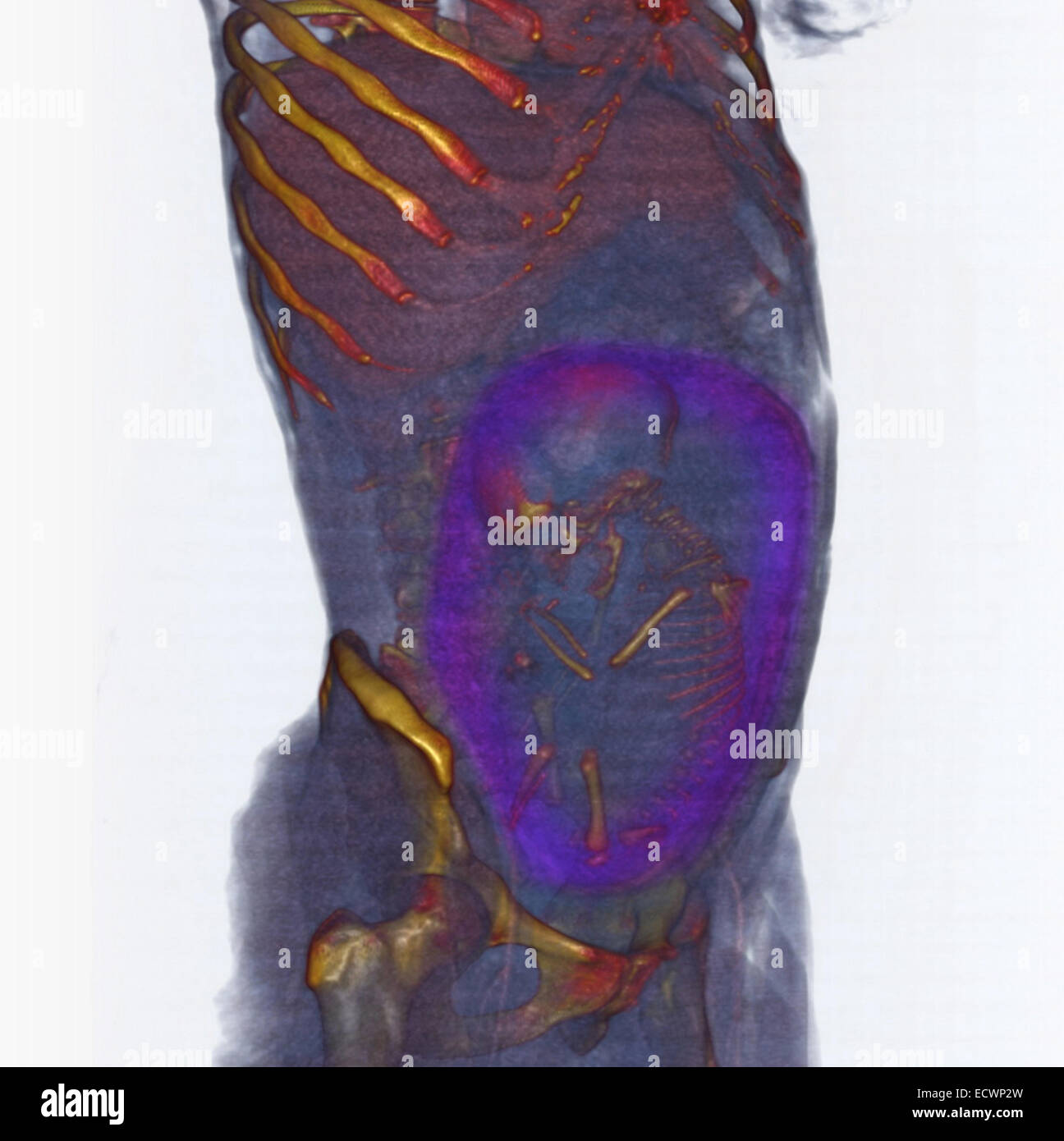 Fetus in utero hi-res stock photography and images - Alamy