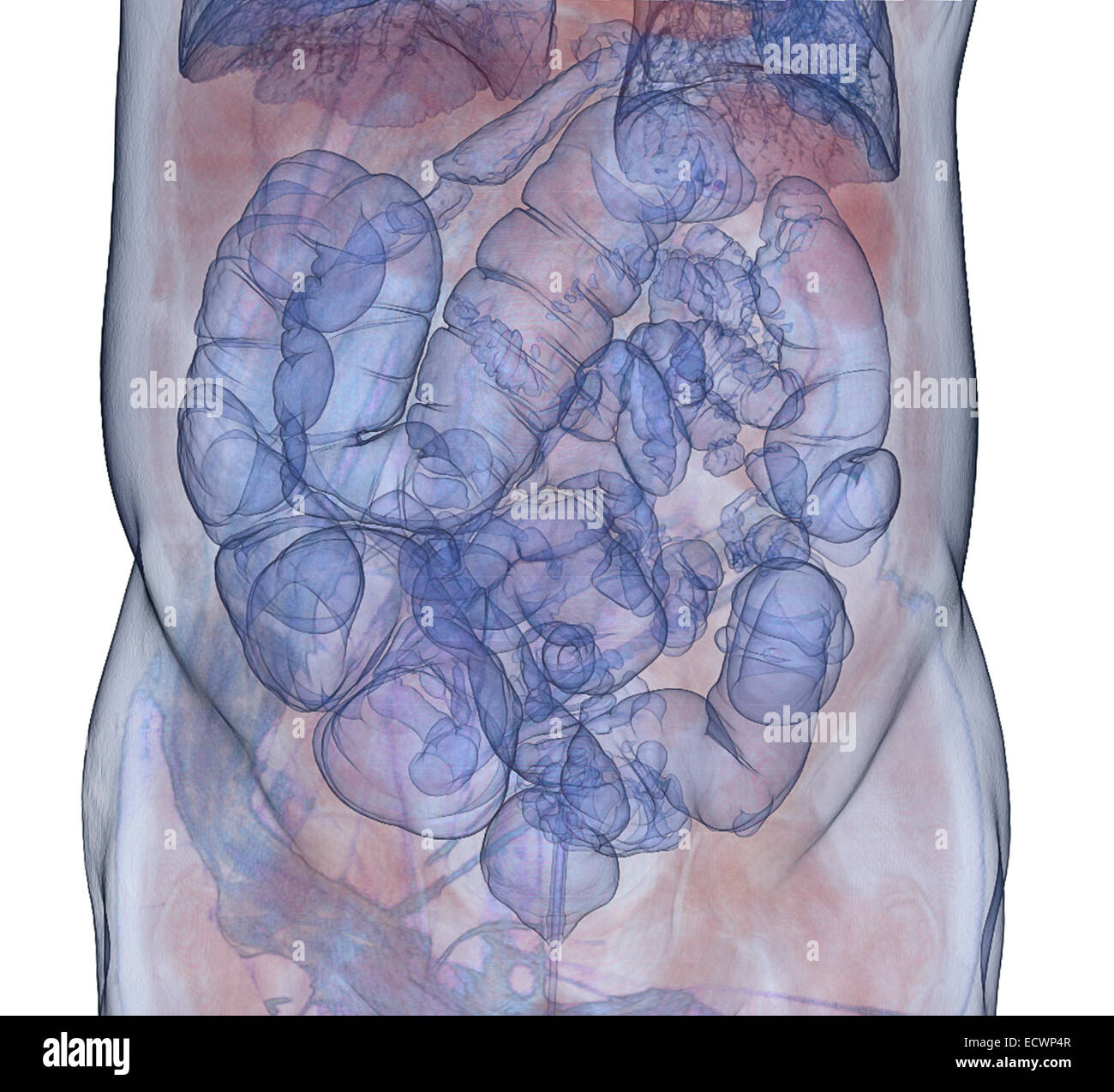 3D CT scan image of a CT colonography procedure Stock Photo - Alamy