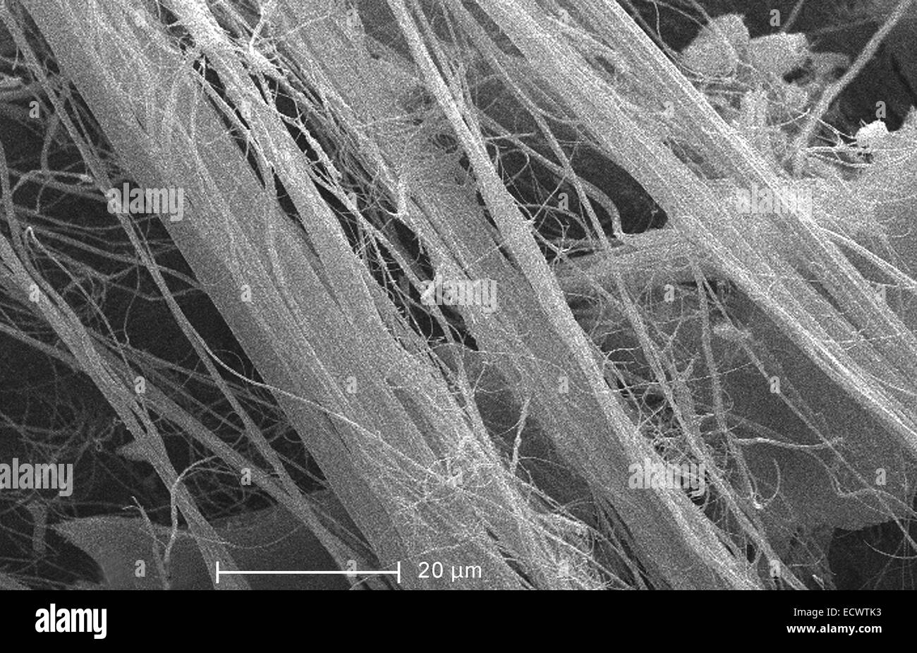 Scanning electron micrograph of chrysotile, white asbestos Stock Photo ...