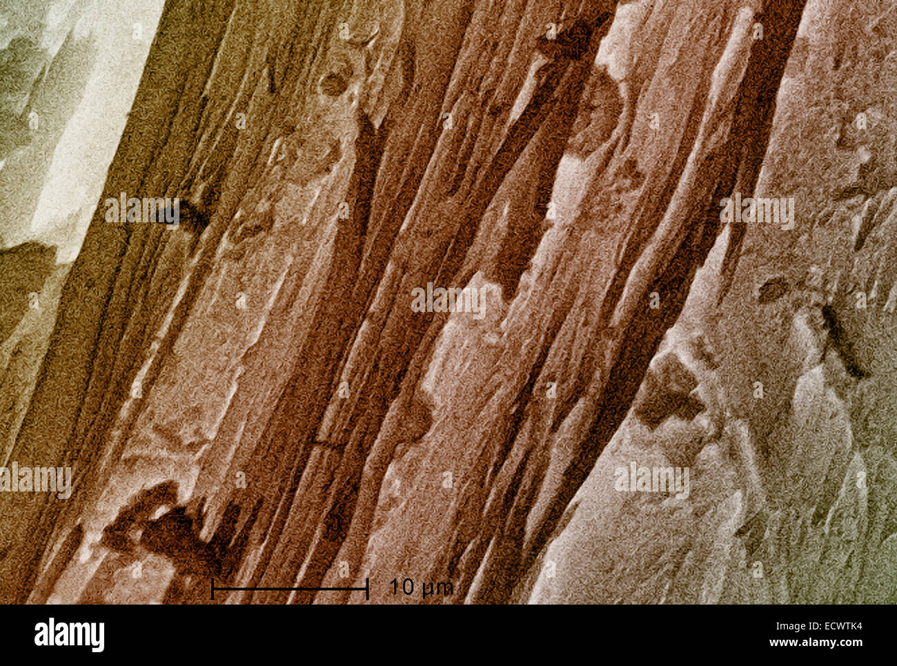 Scanning Electron Micrograph Asbestos High Resolution Stock Photography ...