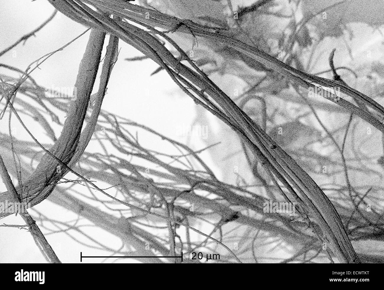 Scanning electron micrograph of chrysotile, white asbestos Stock Photo ...