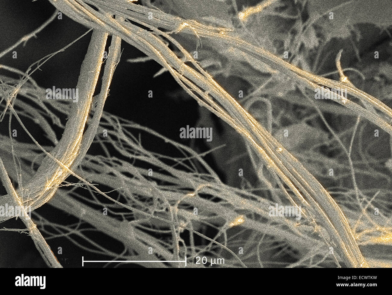 Scanning electron micrograph of chrysotile, white asbestos Stock Photo ...