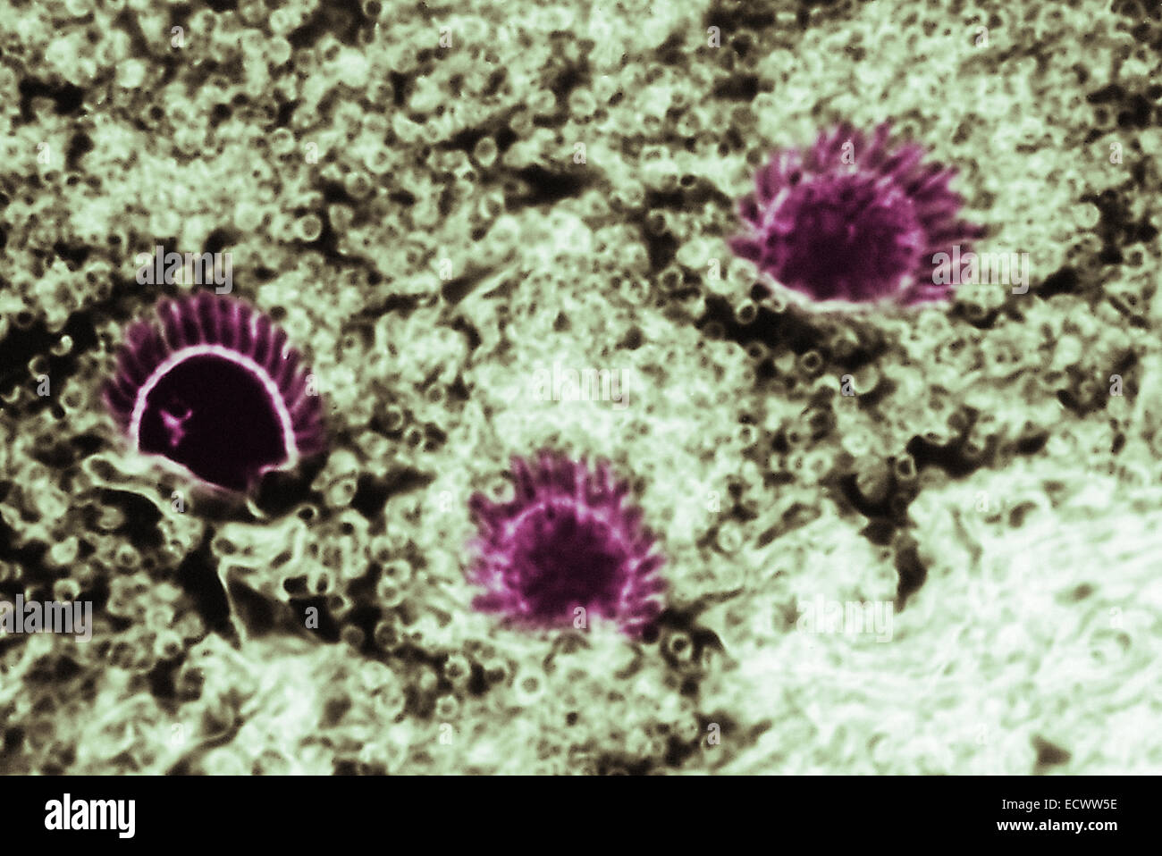 Light microscope fungus hi-res stock photography and images - Alamy